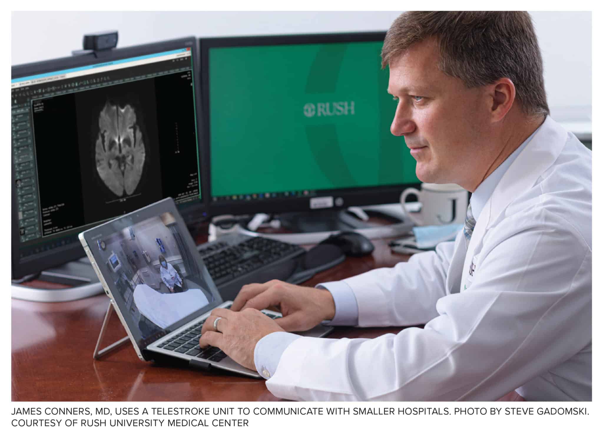 Time is Brain: When treating stroke, every minute counts